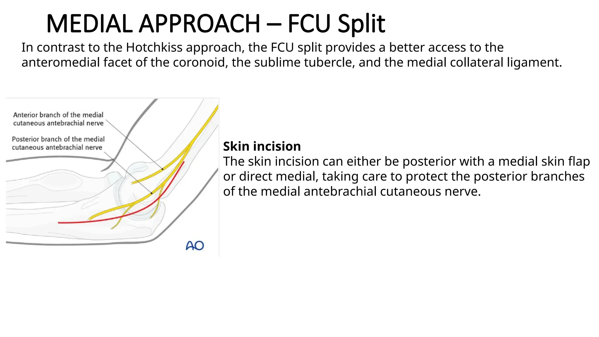 Upper extremity approach - Elbow surgery | PPT