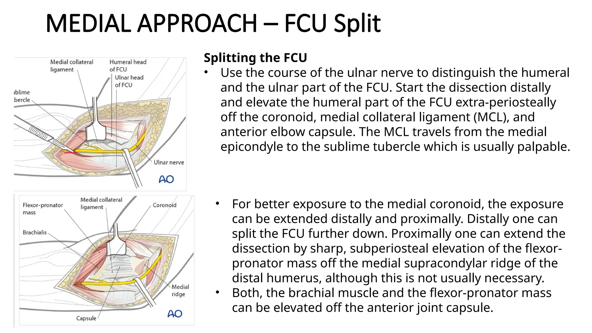 Upper extremity approach - Elbow surgery | PPT