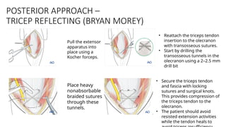 Upper extremity approach - Elbow surgery | PPTX