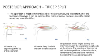 Upper extremity approach - Elbow surgery | PPTX