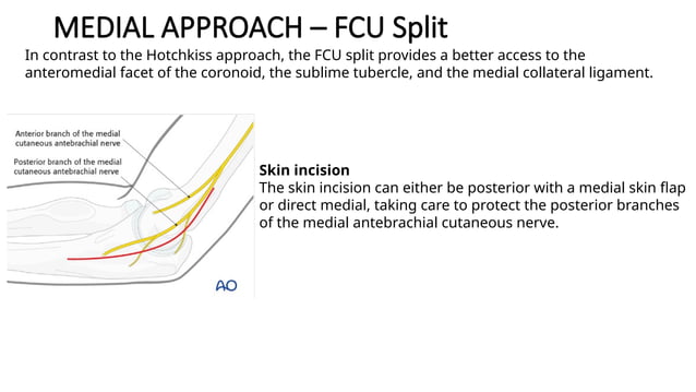 Upper extremity approach - Elbow surgery | PPT