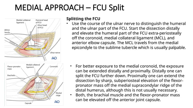 Upper extremity approach - Elbow surgery | PPT