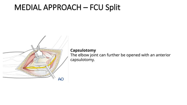 Upper extremity approach - Elbow surgery | PPT