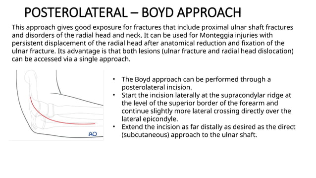 Upper extremity approach - Elbow surgery | PPT