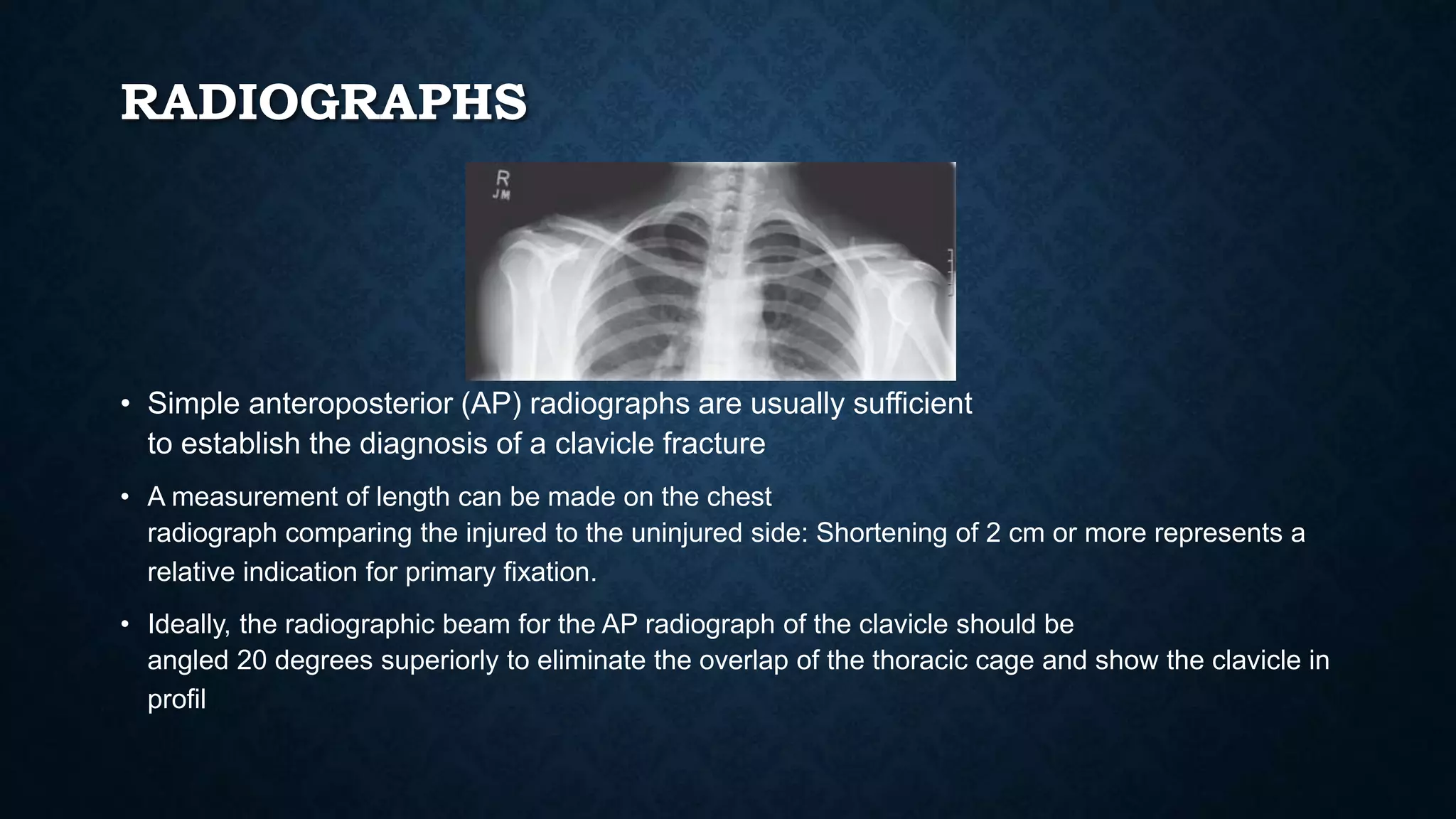 Upper extremity fracture principles | PPTX