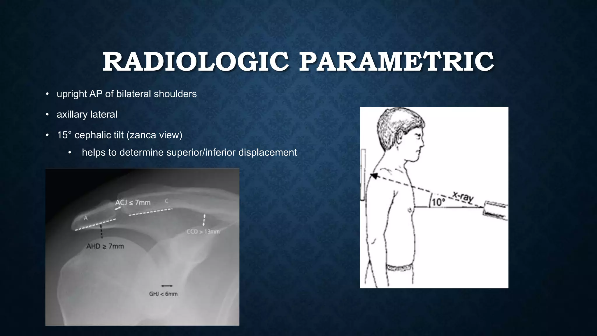 Upper extremity fracture principles | PPTX