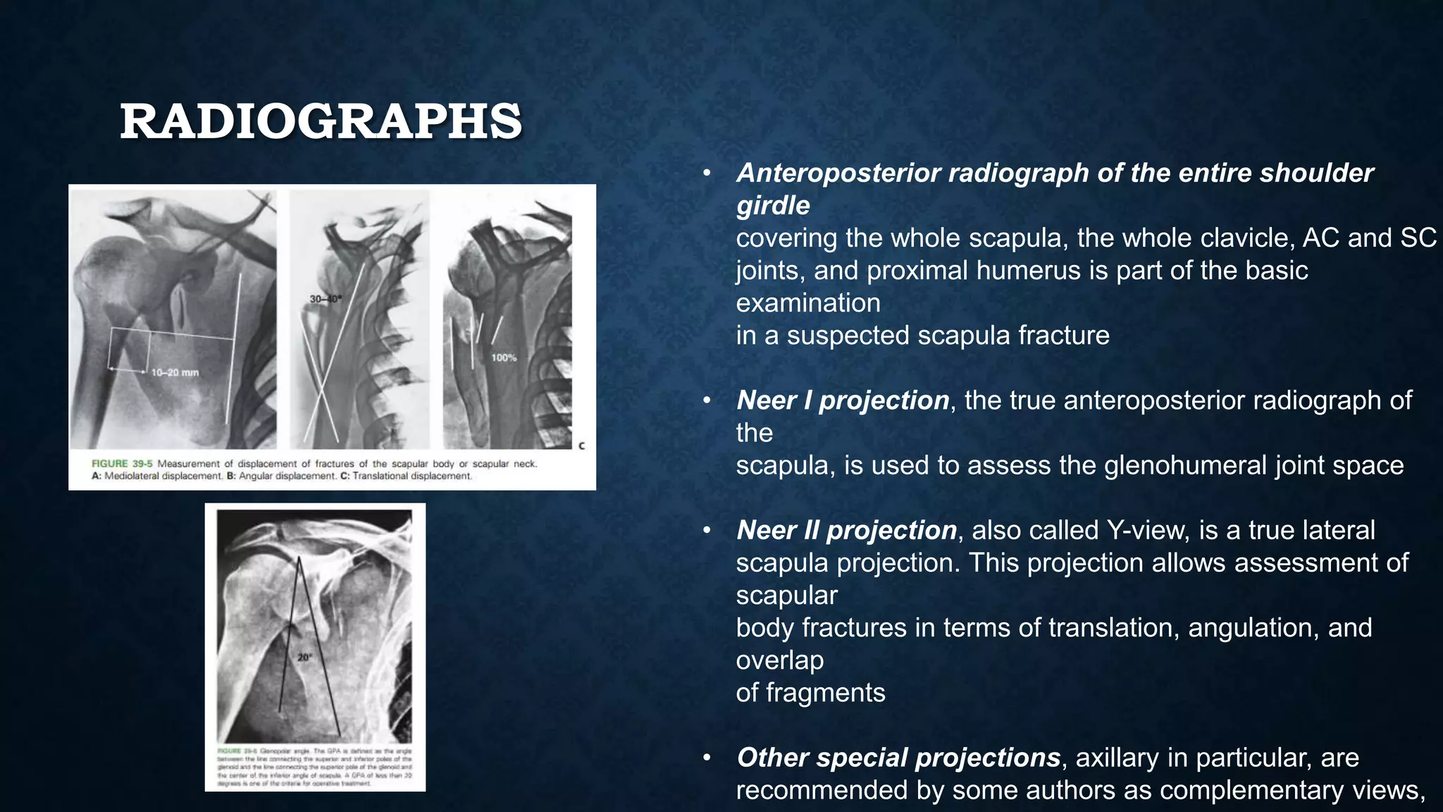 Upper extremity fracture principles | PPTX