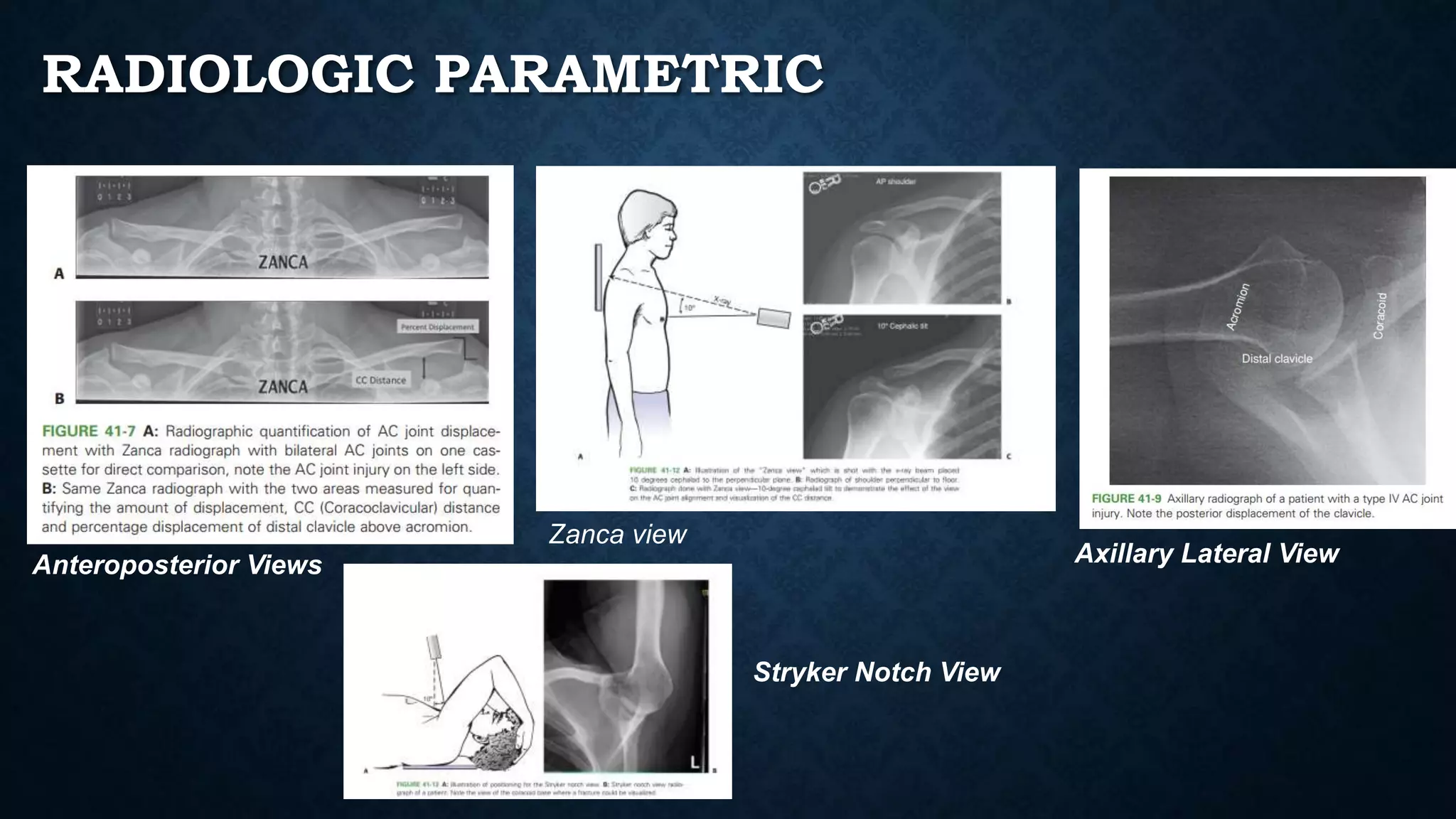 Upper extremity fracture principles | PPTX