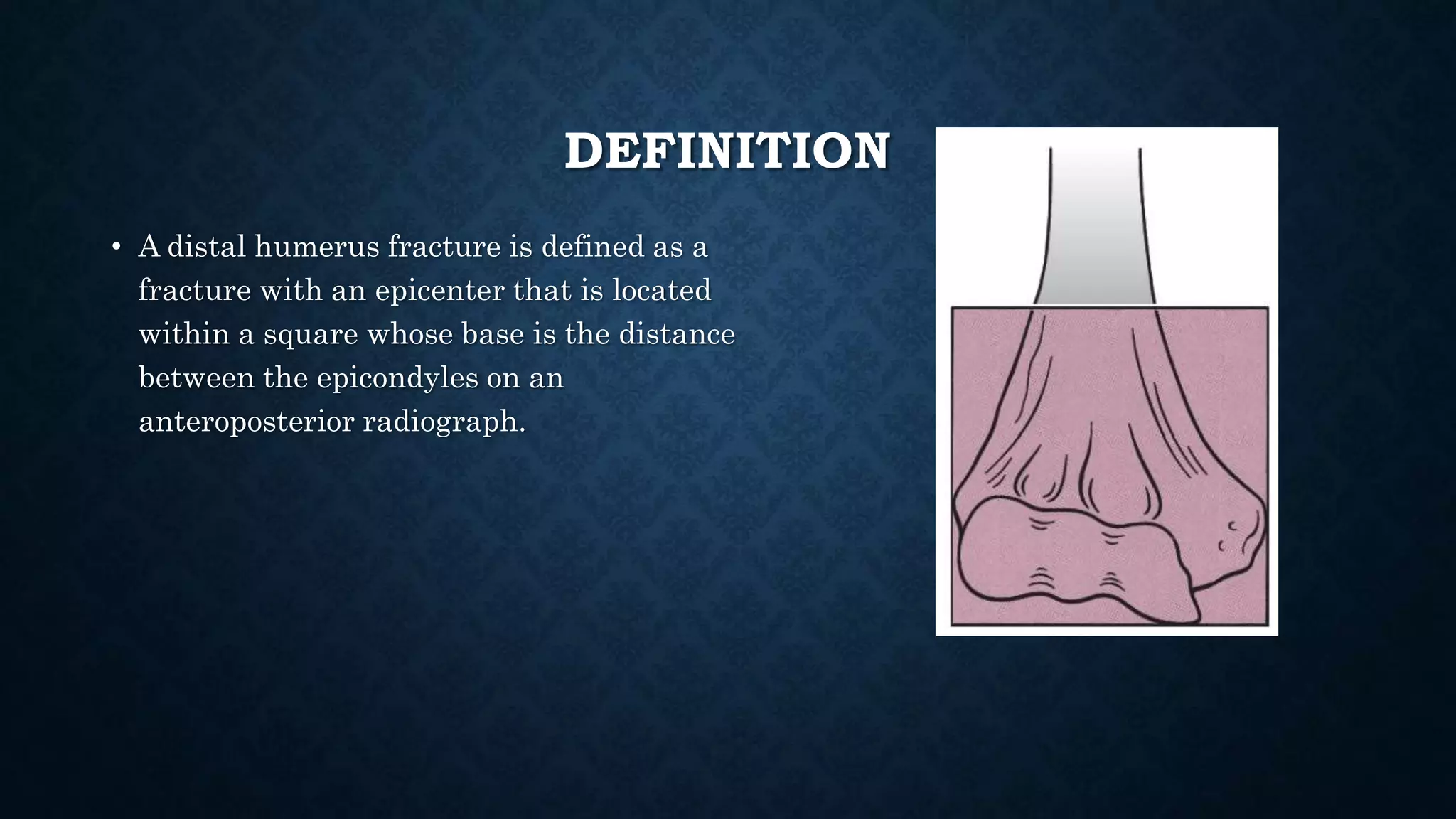 Upper extremity fracture principles | PPTX