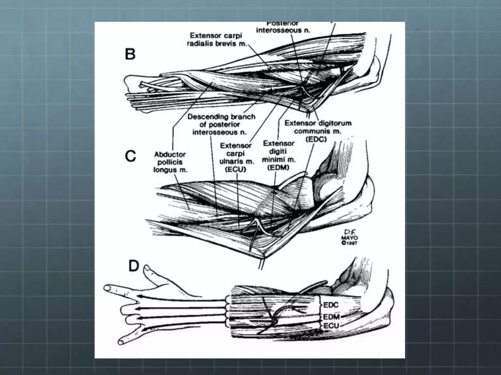 Upper extremity peripheral nerve injury | PPTX