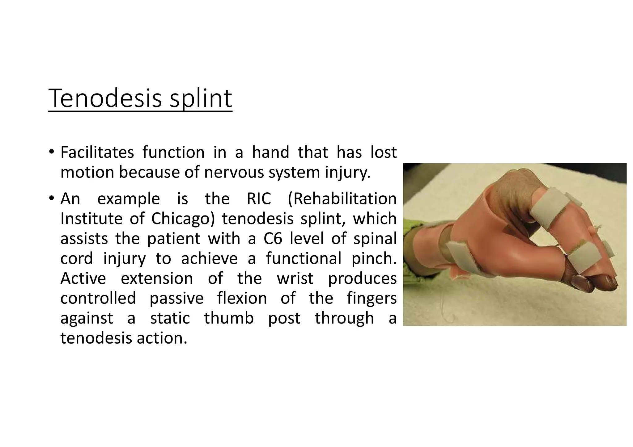 Upper extremity orthoses | PDF