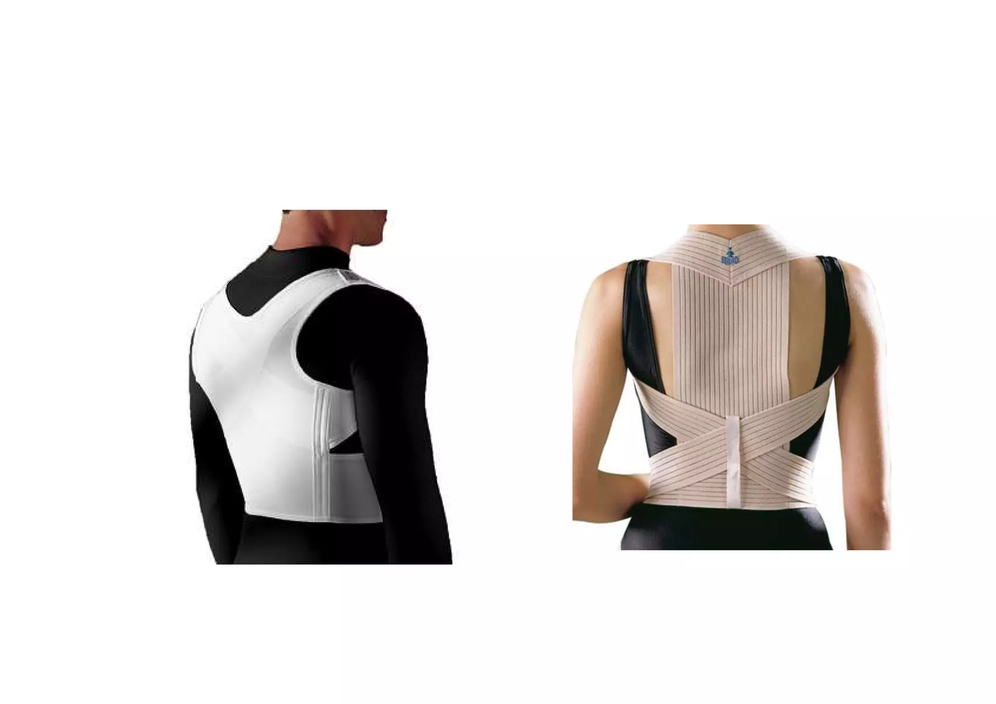 Upper extremity orthoses | PDF