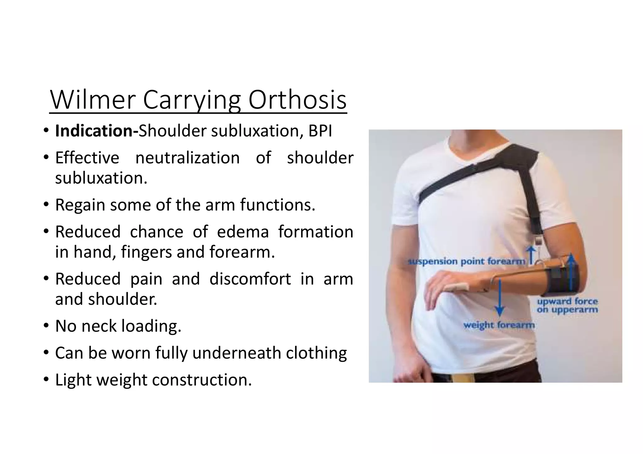 Upper extremity orthoses | PDF