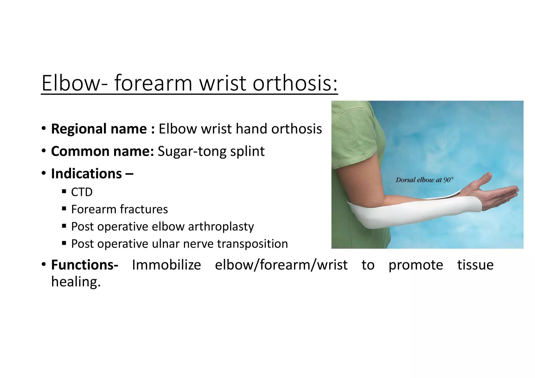 Upper extremity orthoses | PDF