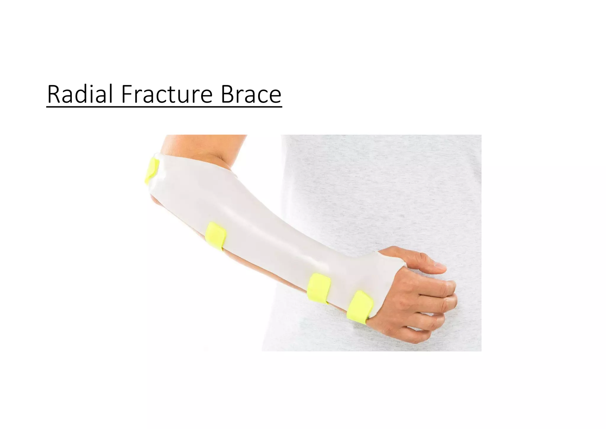 Upper extremity orthoses | PDF