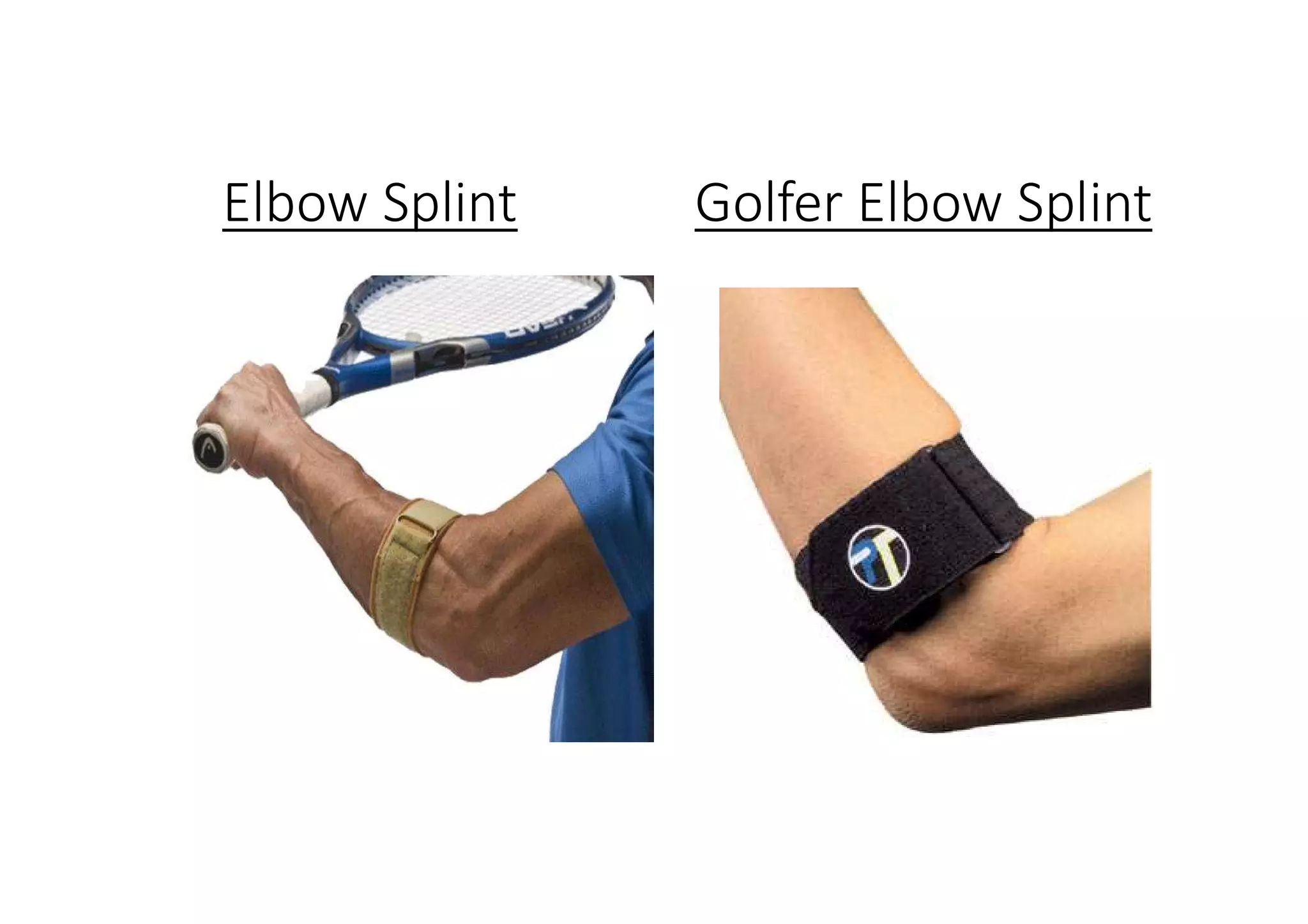 Upper extremity orthoses | PDF