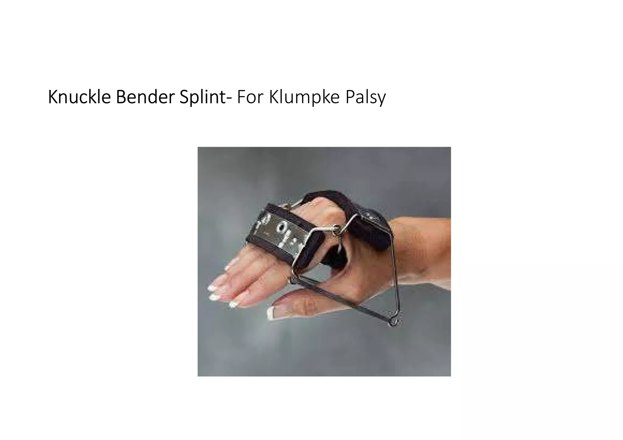 Upper extremity orthoses | PDF