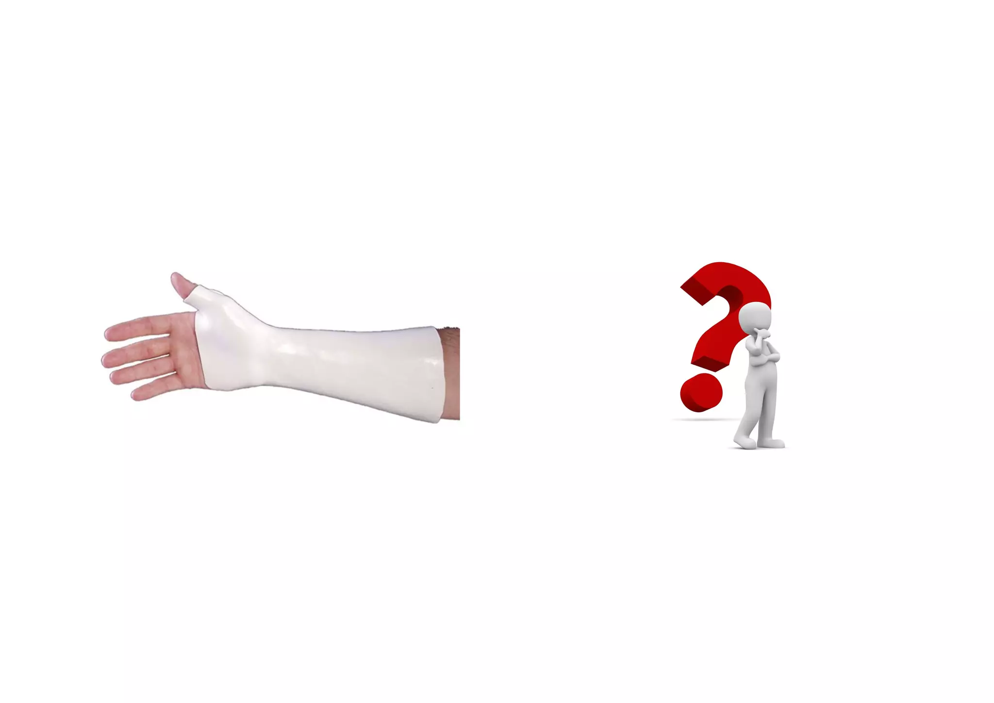 Upper extremity orthoses | PDF