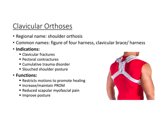 Upper extremity orthoses | PDF