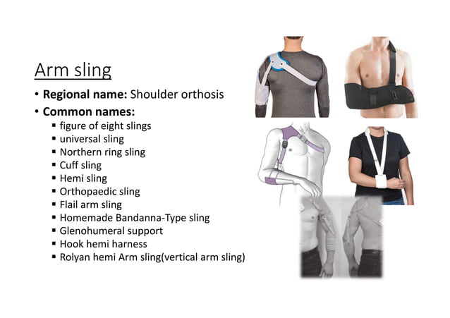 Upper extremity orthoses | PDF