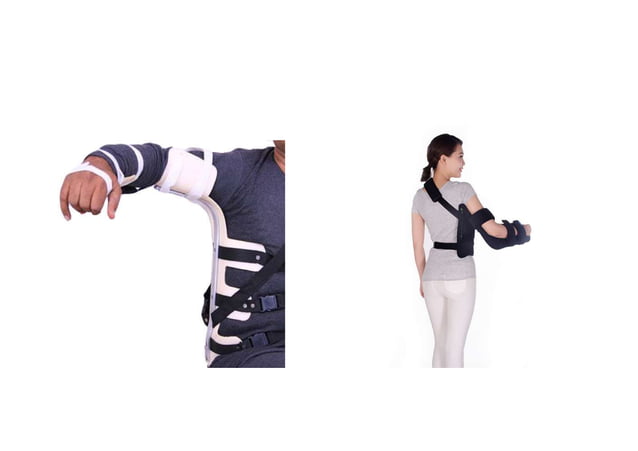 Upper extremity orthoses | PDF