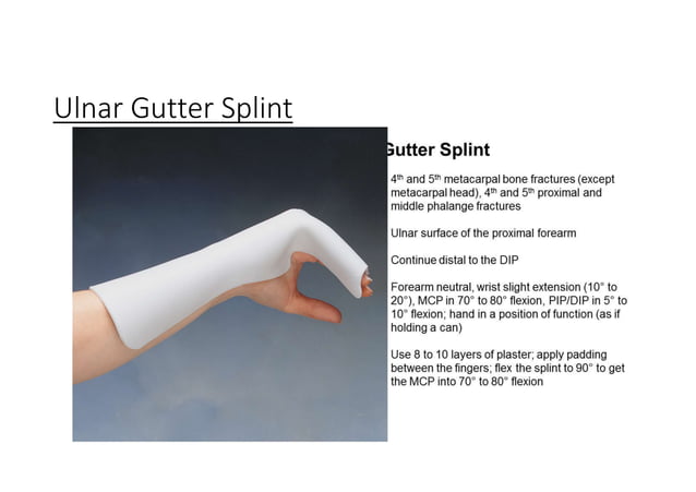 Upper extremity orthoses | PDF