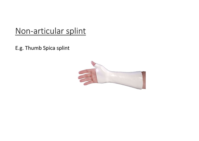 Upper extremity orthoses | PDF