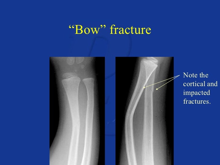 Upper extremity pathology