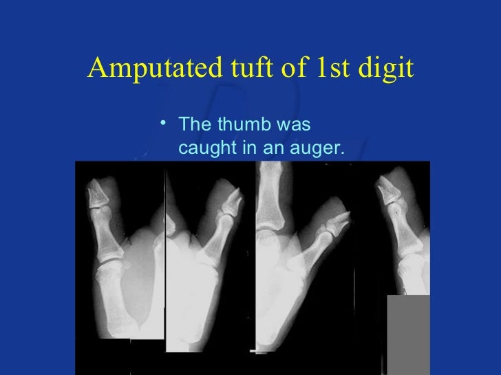 Upper extremity pathology