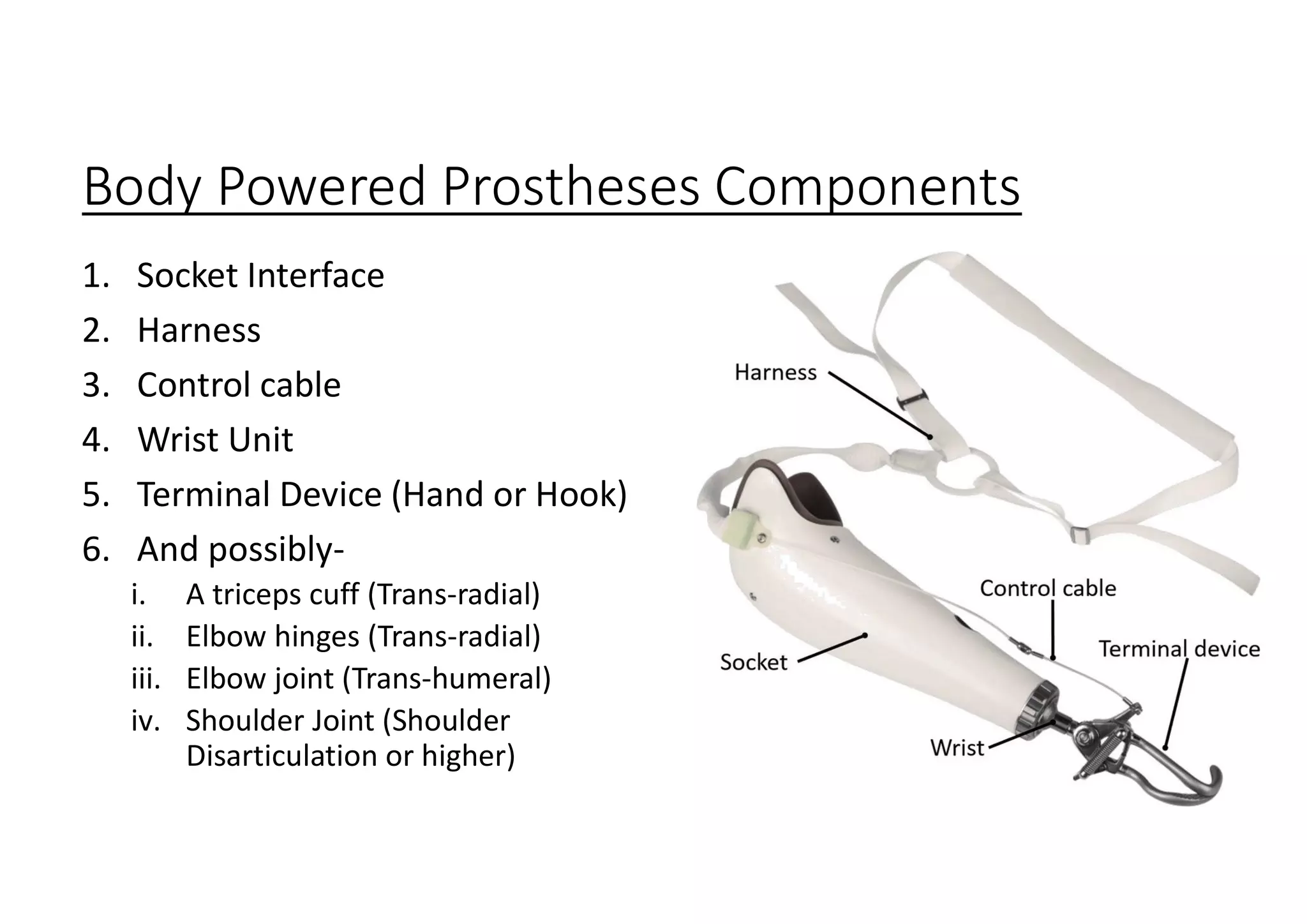 Upper Extremity Prostheses | PDF