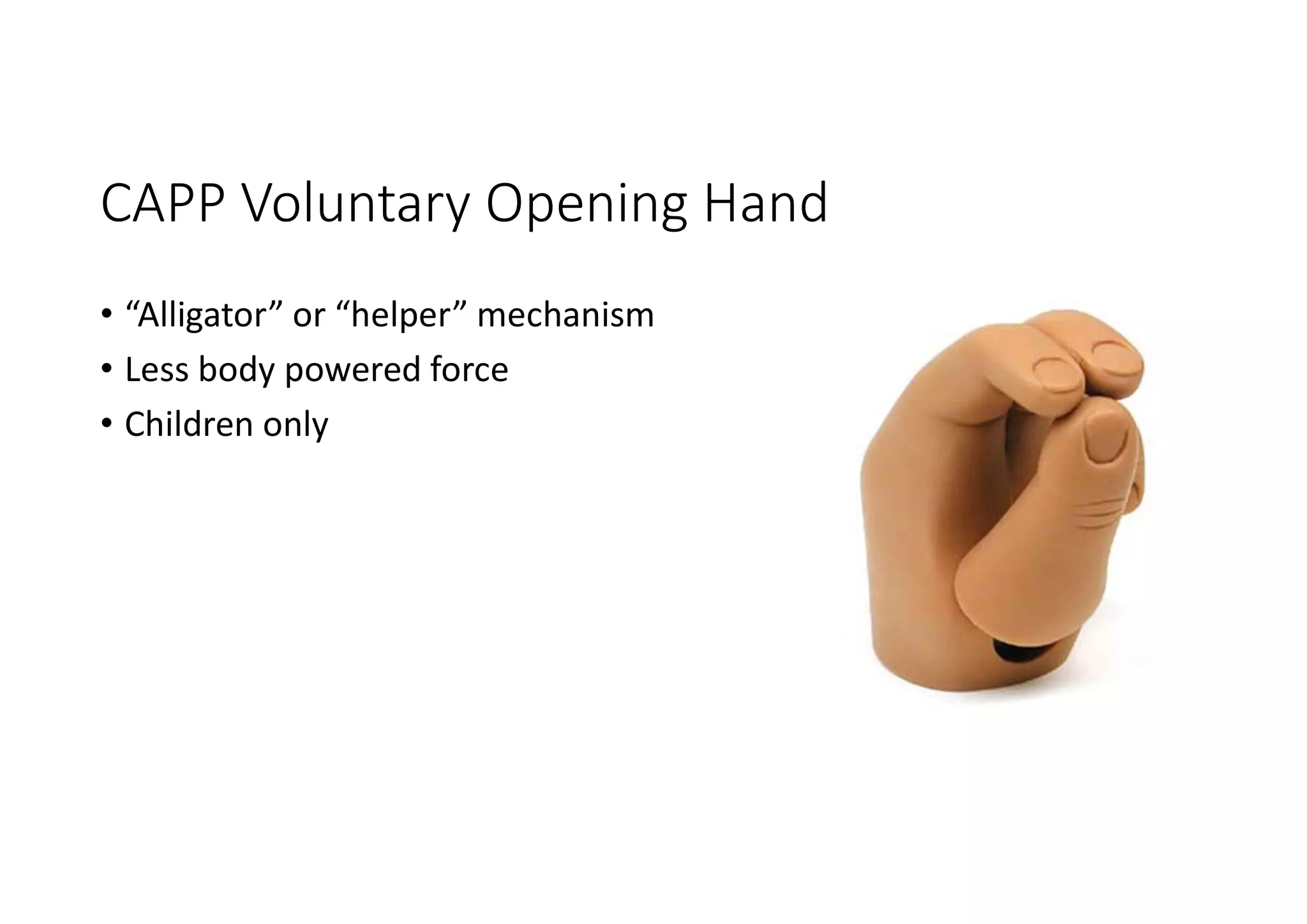 Upper Extremity Prostheses | PDF