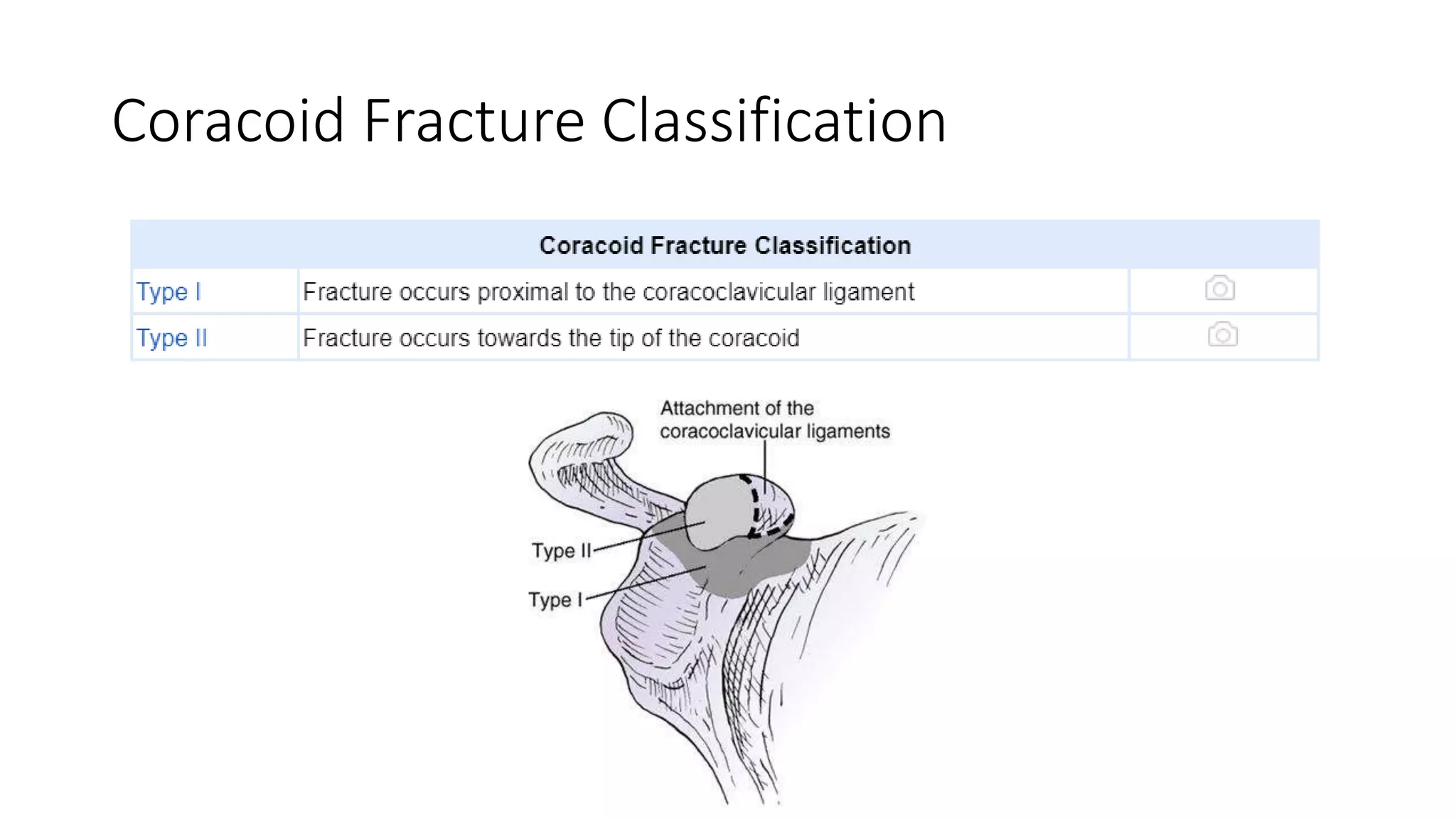 Upper extremity (shoulder fracture | PPTX
