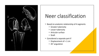 Upper extremity (shoulder fracture | PPTX | Death, Injury, or Military ...