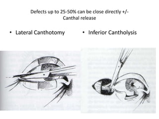 Upper eyelid reconstruction | PPTX