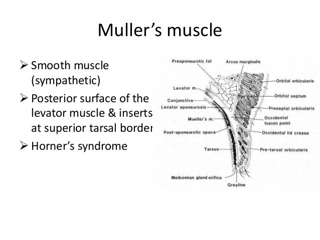 Upper eyelid reconstruction