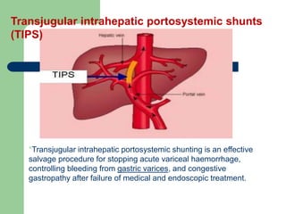 Upper Gastrointestinal Bleeding.pptx