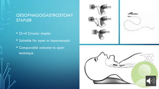 upper GI anastomosis principles - master of surgery | PPT
