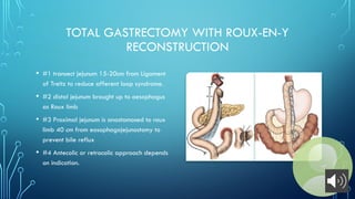 upper GI anastomosis principles - master of surgery | PPT