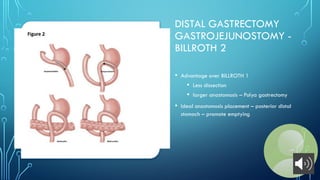 upper GI anastomosis principles - master of surgery | PPT