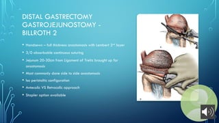 upper GI anastomosis principles - master of surgery | PPT