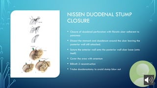 upper GI anastomosis principles - master of surgery | PPT