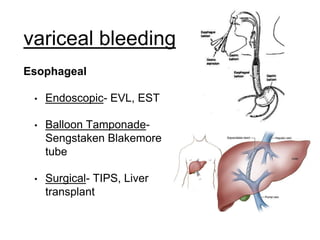 Upper gi bleed | PPT