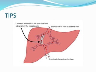 UPPER GI BLEED.pptx | Blood Disorders | Diseases and Conditions