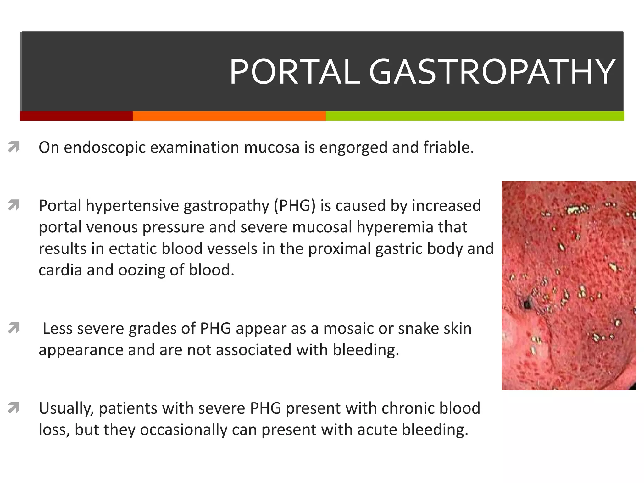 Approach to Management of Upper Gastrointestinal (GI) Bleeding | PPTX