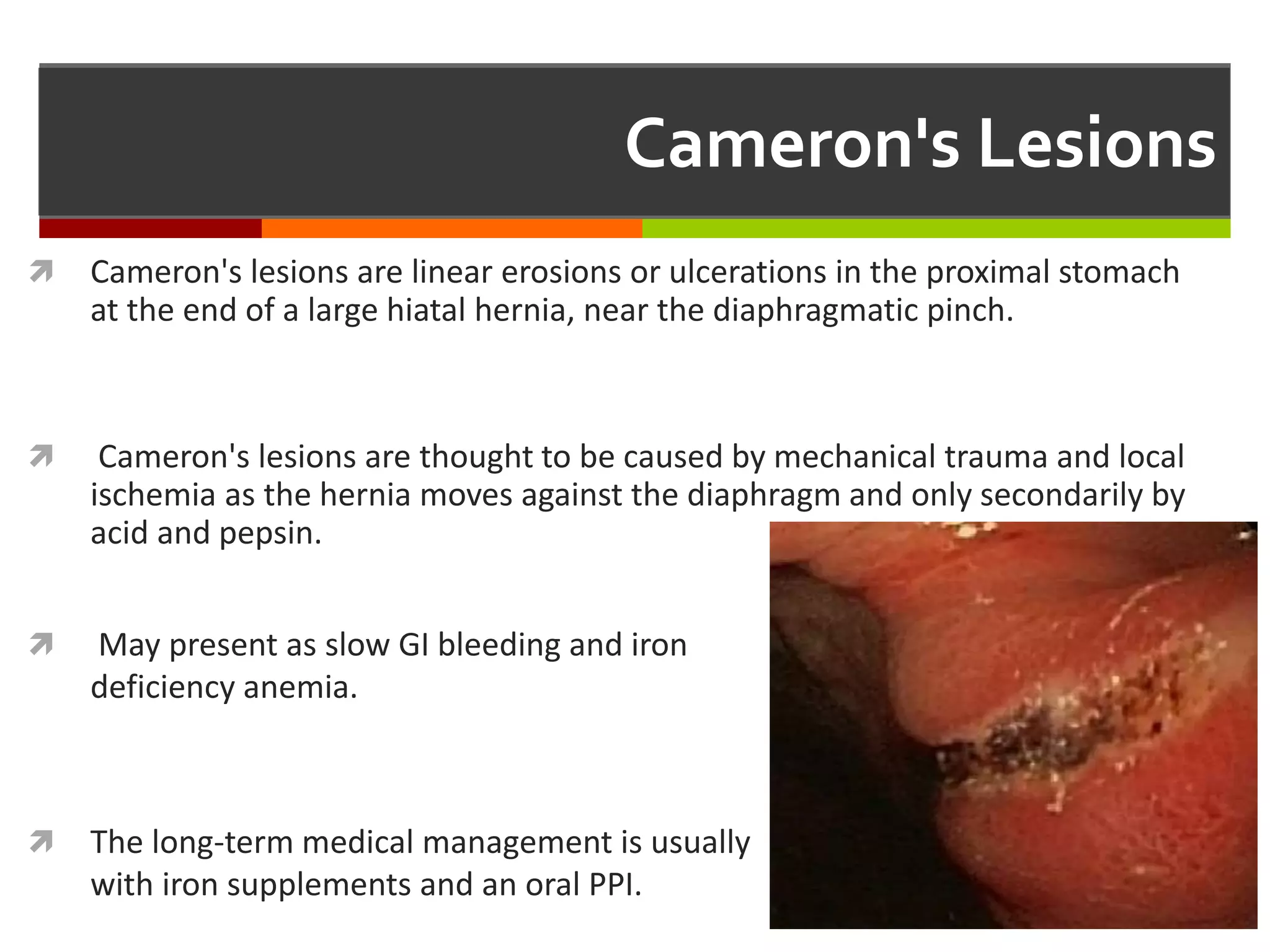 Approach to Management of Upper Gastrointestinal (GI) Bleeding | PPTX