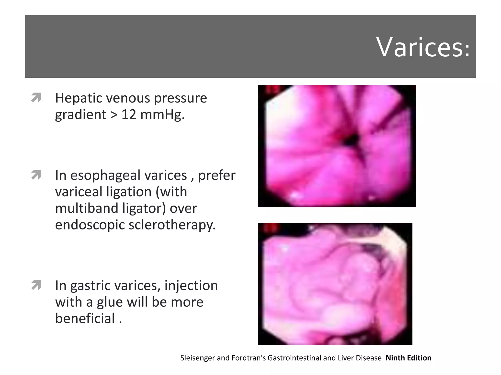 Approach to Management of Upper Gastrointestinal (GI) Bleeding | PPTX