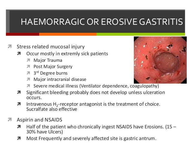 Approach to Management of Upper Gastrointestinal (GI) Bleeding