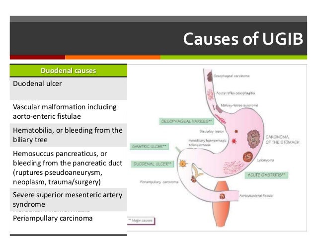 Approach to Management of Upper Gastrointestinal (GI) Bleeding