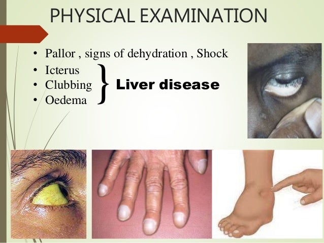 Uppergibleeding 150402032909-conversion-gate01-converted