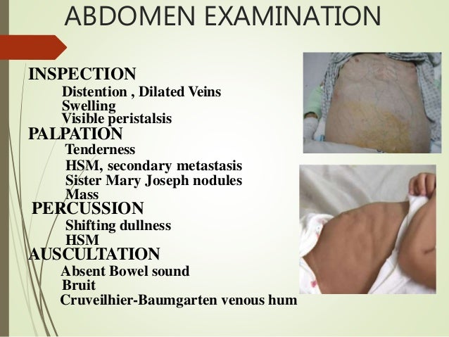 Uppergibleeding 150402032909-conversion-gate01-converted